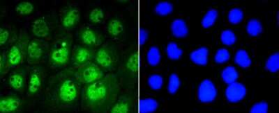STAT3 [p Ser727] Antibody (SY24-09) (NBP2-67433): Novus Biologicals